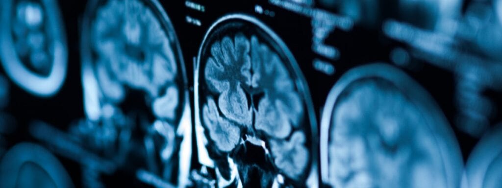 Was ist ein MRT? | Radiologie-Eins